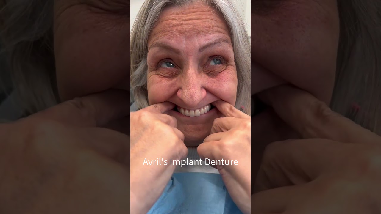 Implant Denture Removal & Placement