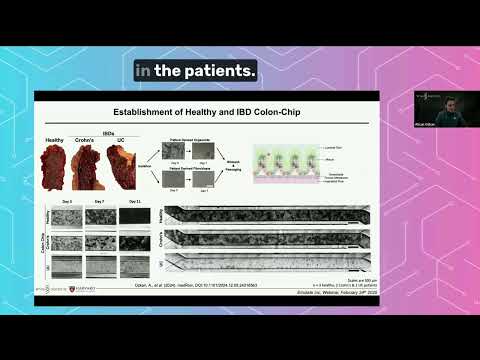 Webinar Preview: Human Organ Chips Reveal New Inflammatory Bowel Disease Drivers