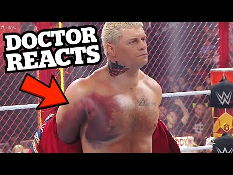Watch a Doctor Explain How WWE Star Cody Rhodes Tore His Pec