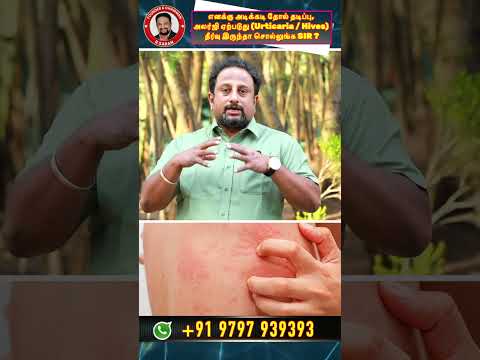 How to treat Hives (Urticaria) in Tamil ?