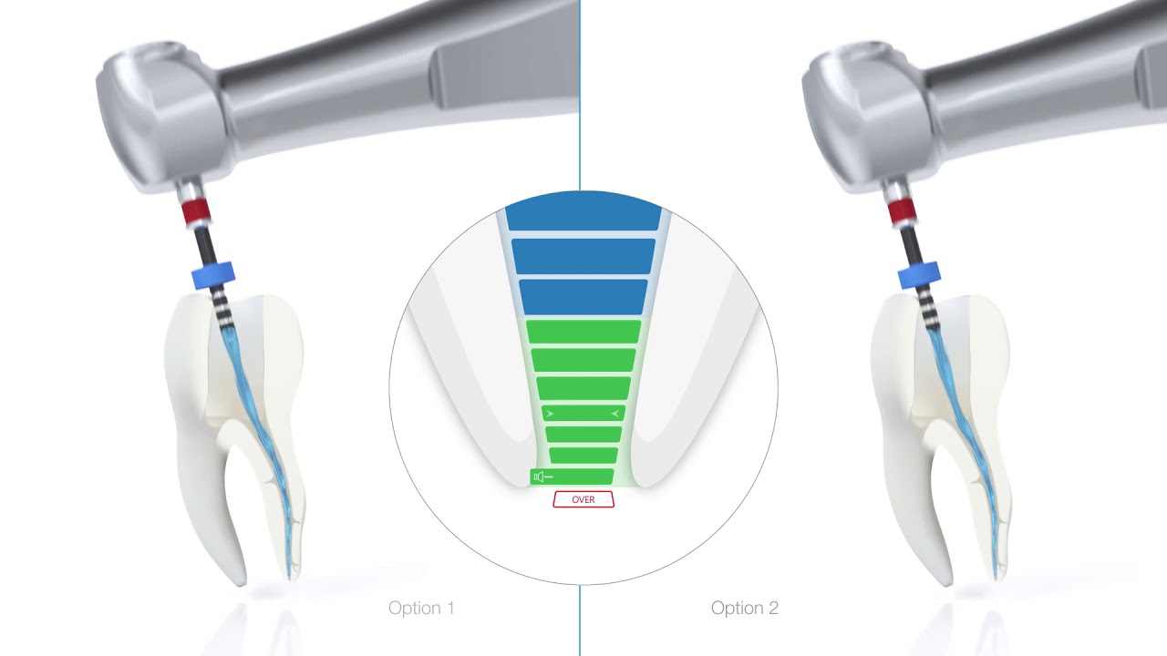 VDW Dental · How To: VDW.ROTATE - Step by step