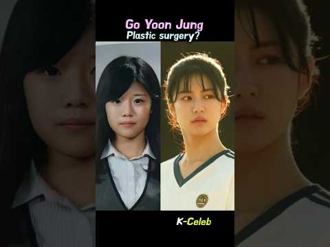 plastic surgery controversy? #disney #movingkdrama #goyoonjung