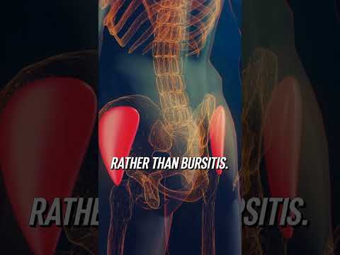 Why Lateral Hip Pain Is Likely Gluteal Tendinopathy, Not Bursitis! #shorts #physiotherapy