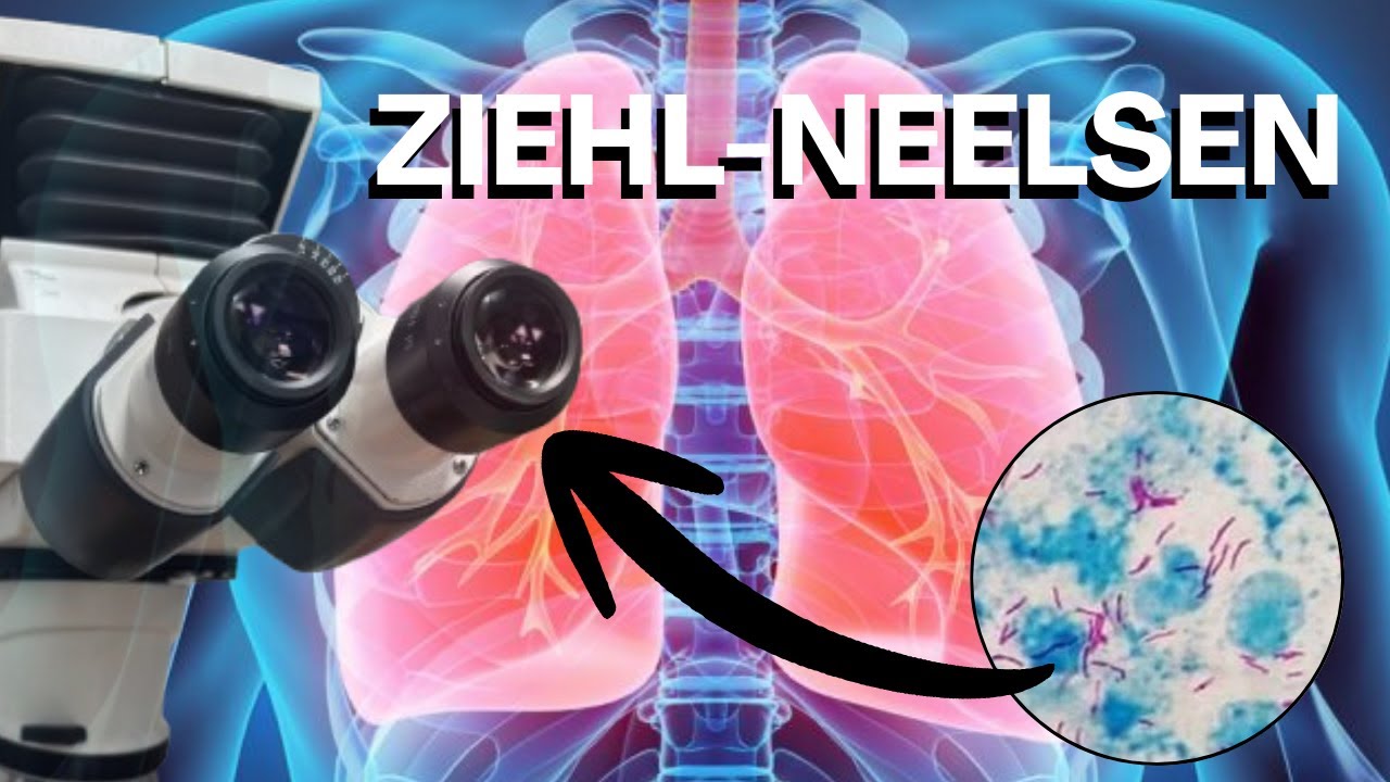 BAAR al microscopio | Tinción de Ziehl-Neelsen (Paso a Paso)