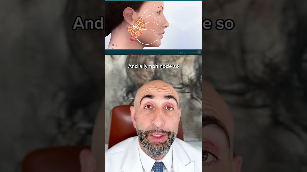 How to distinguish between a parotid tumor and swollen lymph nodes? Dr. Larian explains.