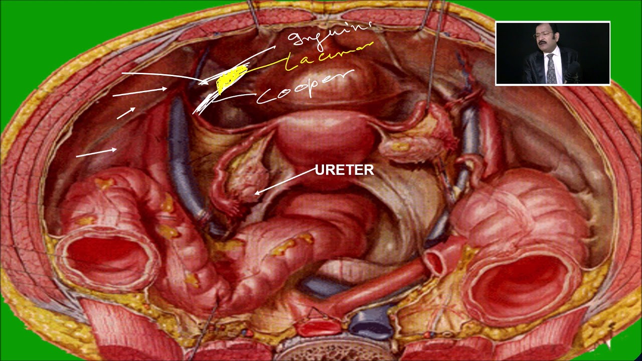 Laparoscopic Anatomy of Pelvis by Dr R K Mishra