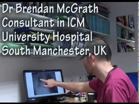 Bronchial Wash ICU Narrated