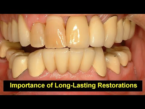 Long Lasting Restorations Full Video