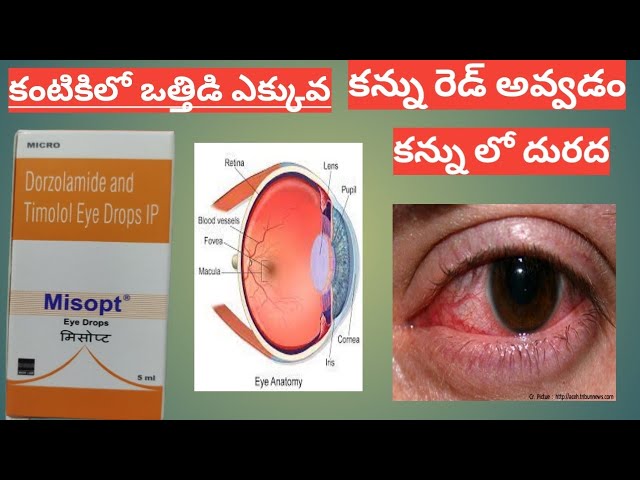 Eye Drops - Dortas T Eye Drops Trader - Retailer from Nagpur