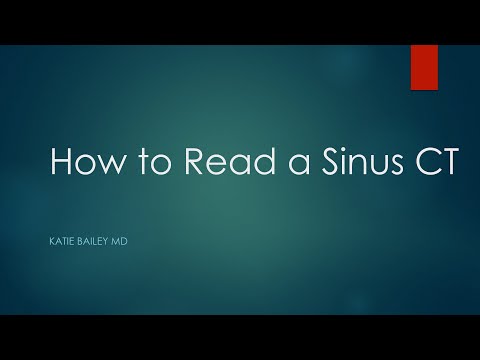 How to read a Sinus CT