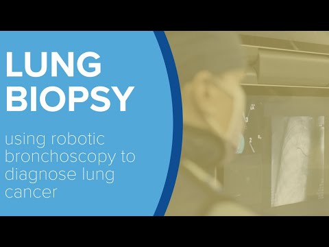 Robotic Bronchoscopy for Lung Biopsy - Yale Medicine Explains