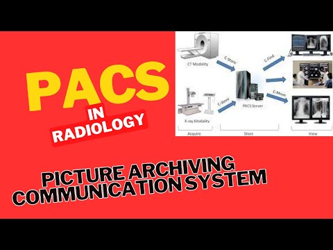 WhAT iS PACS# Picture Archiving Communication System| PACS In Radiology#Introduction#History