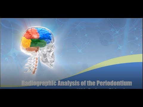 Radiographic Analysis of the Periodontium with Professor Richardson