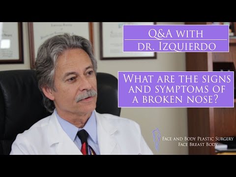 What are the signs and symptoms of a broken nose