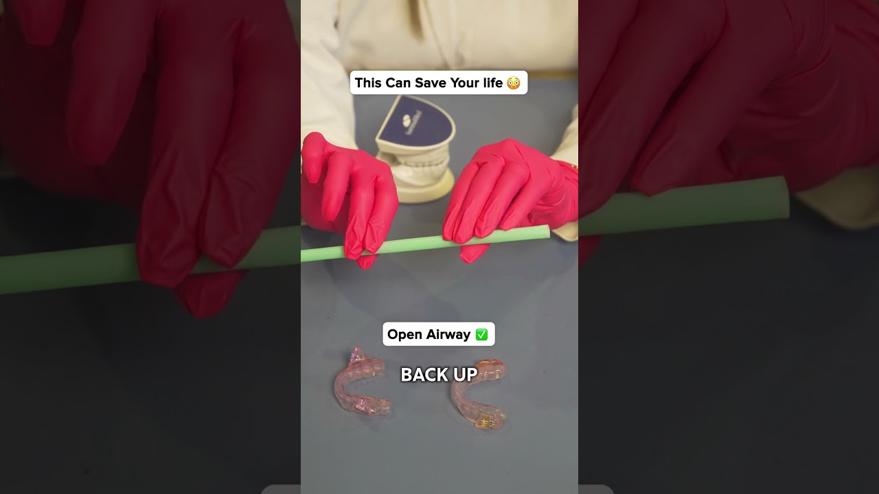 This Sleep Device Could Save Your Life 😴 | Dentist Explains Sleep Apnea & Oral Health Risks