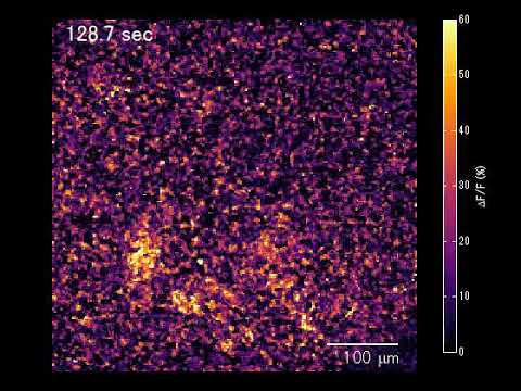Synaptic pruning: How neurons compete to lose their link