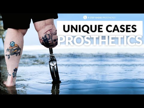 New YouTube Videos – Van Ness Rotationplasty and Hip Disarticulation ...