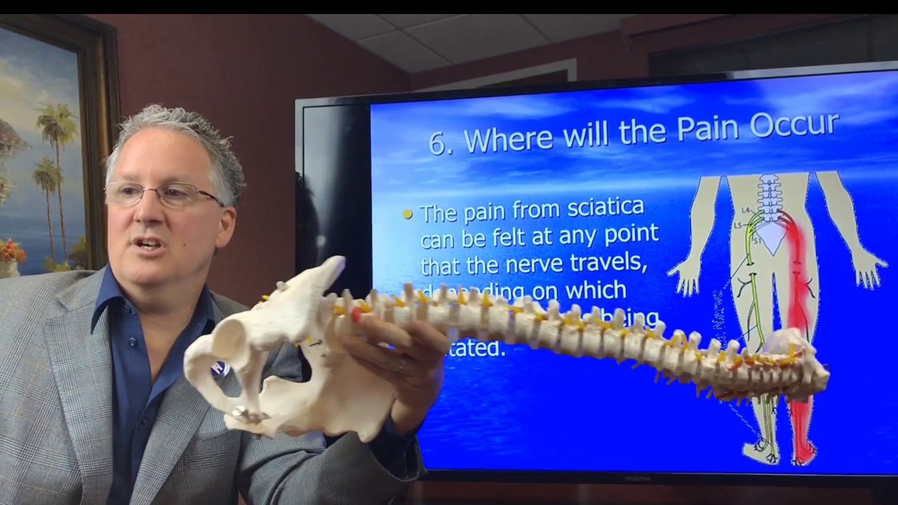 10 Interesting Facts About Sciatica