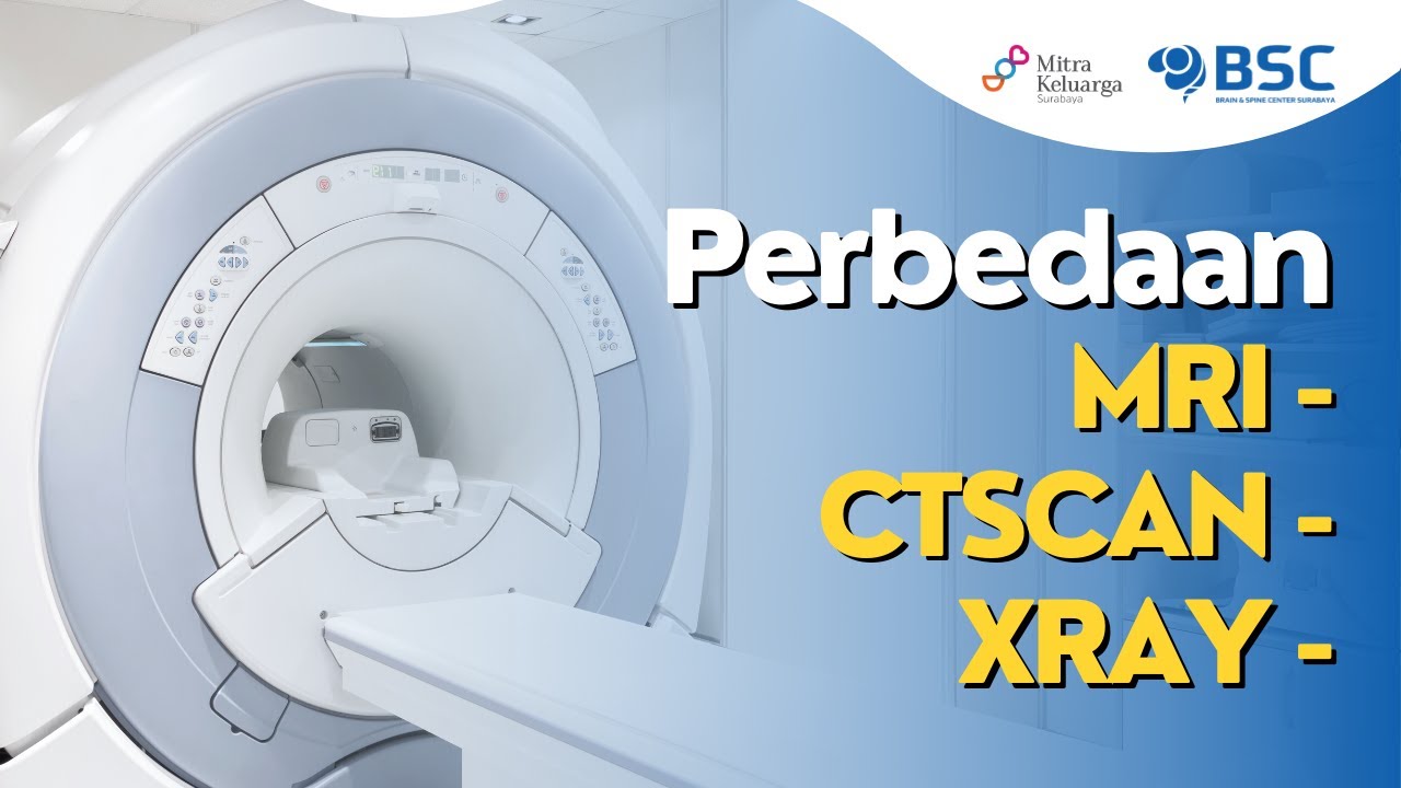 Perbedaan MRI, CT-Scan dan Rontgen