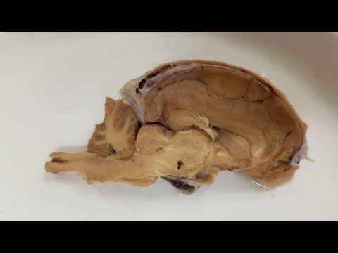 Sheep brain quiz