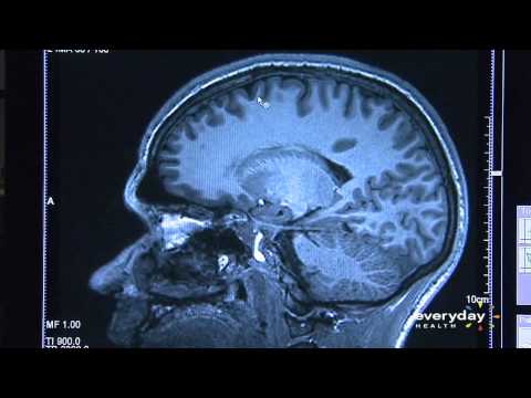 A Blood Test For Alzheimer's?
