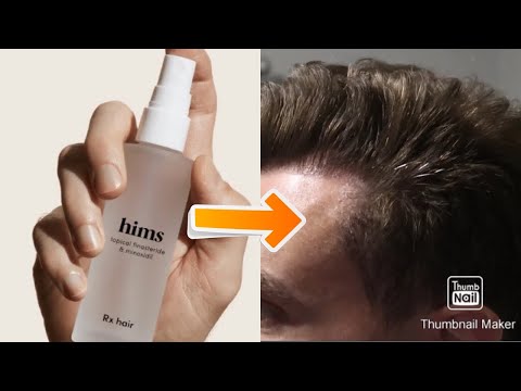 Should you take topical finasteride for hair loss? (Featuring Steve Cook)
