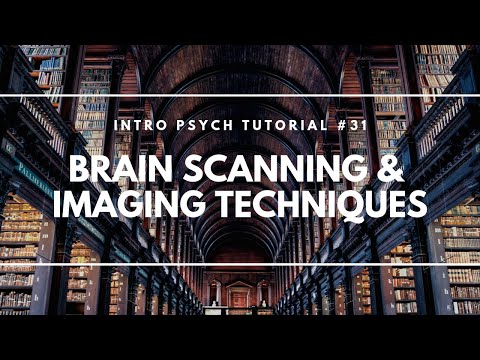 Brain Scanning and Imaging Techniques (Intro Psych Tutorial #31)