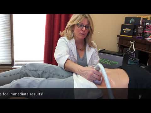 Fat Freezing with Cryo T Shock is the safe and fast way to sculpt your body!