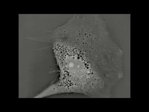 Pulmonary Arterial Hypertension - live cell monitoring with the 3D Cell Explorer