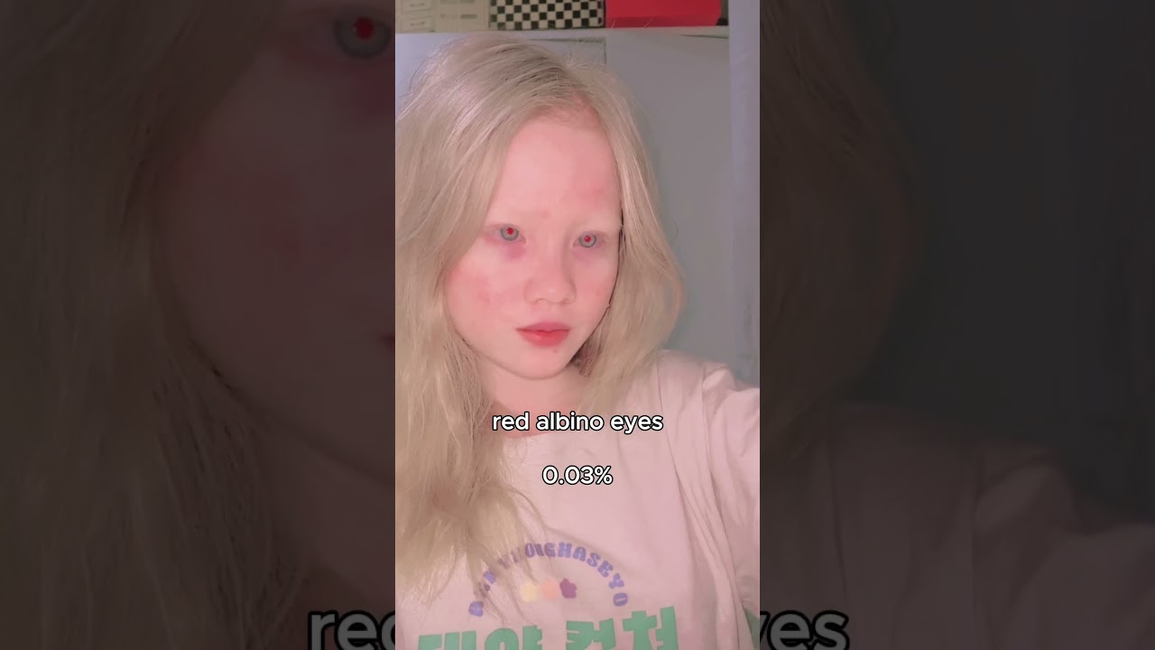 Most striking and rare eye colors! Which color are your eyes?  #features #eyes #eyecolor  #model