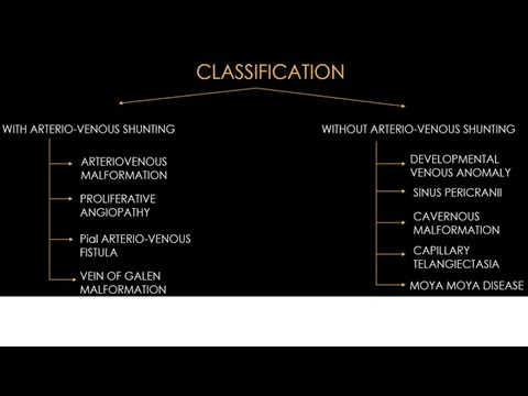 BRAIN AVMS MULTIPLE IN MAN ( ARTERIOVENOUS MALFORMATIONS ) OR CVA ( CEREBRAL VASCULAR ANGIOPATHY )