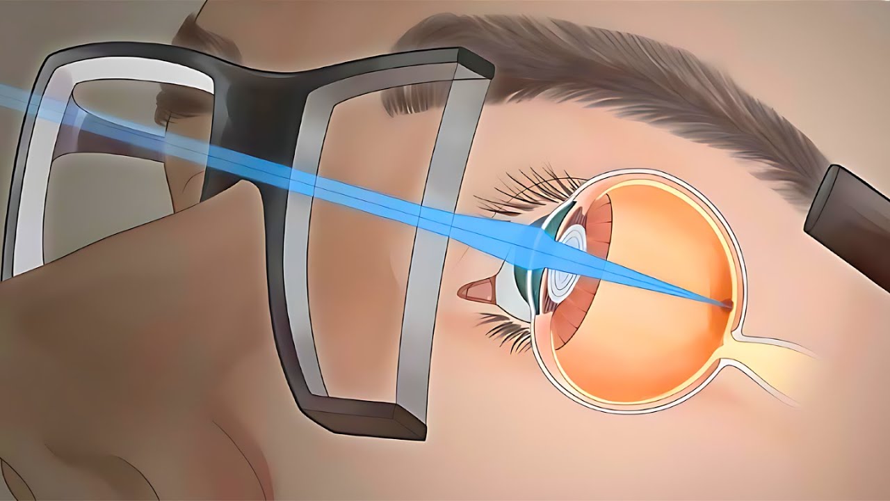 How Glasses Work: The Science Behind Clear Vision