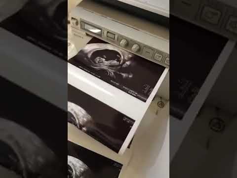 UPP 110S & UPP 110HG ultrasound thermal paper roll