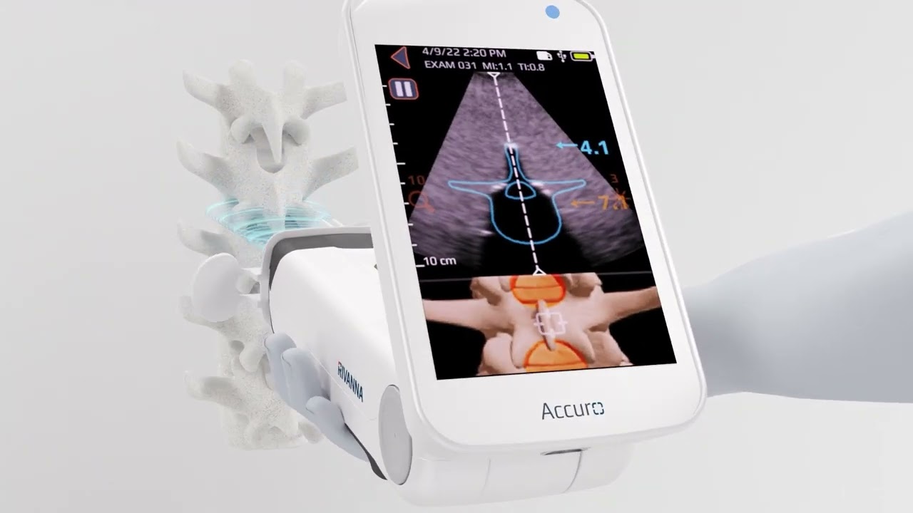 How to Operate Accuro [7 Tips]