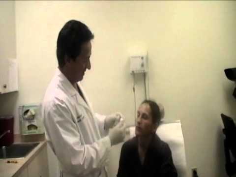 Botox Side Effects -Everything You Need To Know