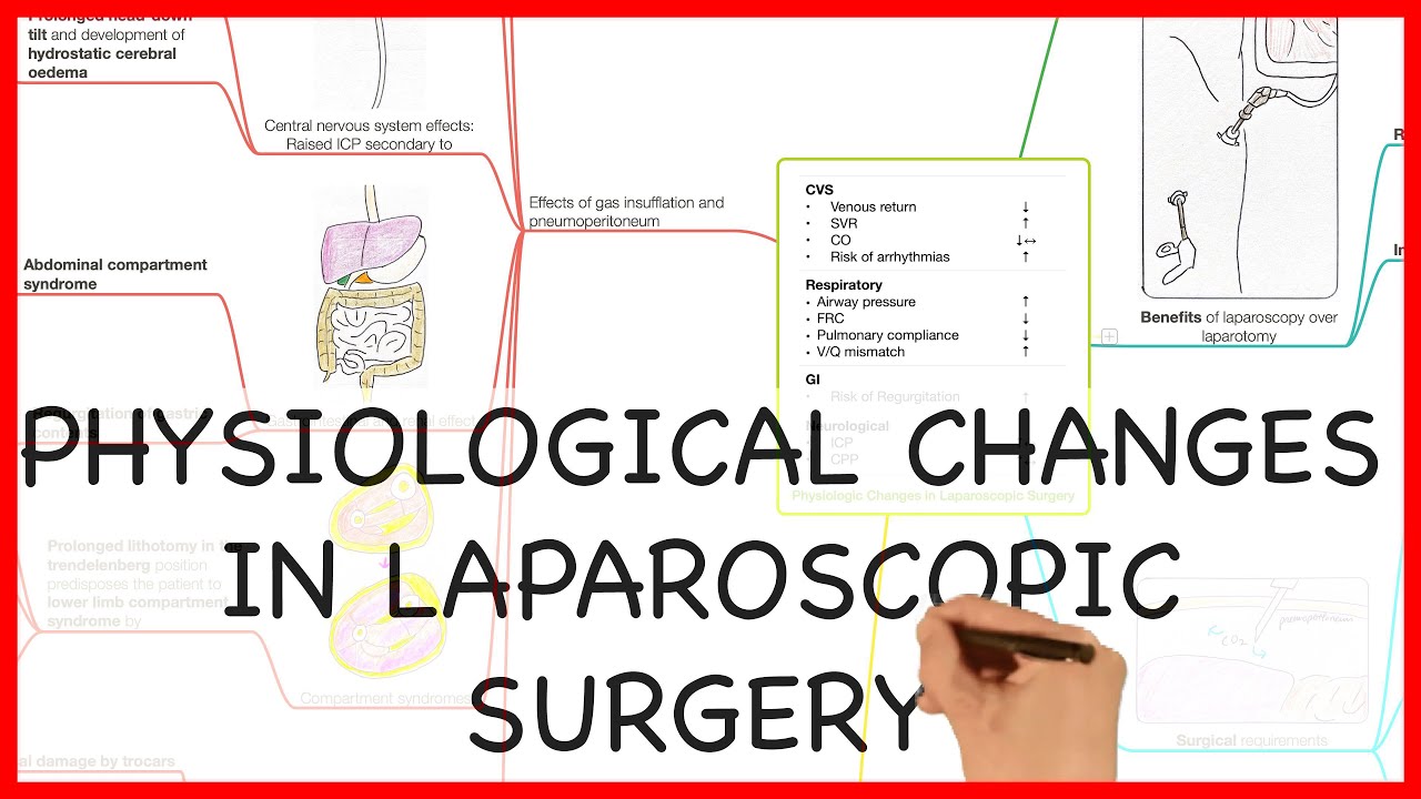 PHYSIOLOGIC CHANGES IN LAPAROSCOPIC SURGERY- PHYSIOLOGY SERIES