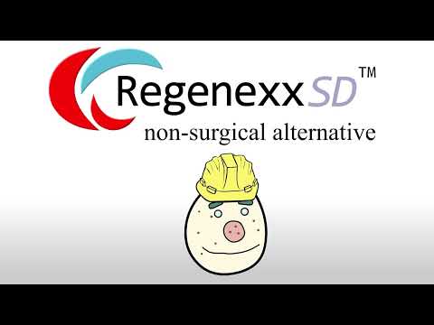 Knee Replacement Alternative at the Centeno Schultz Clinic Regenexx HQ