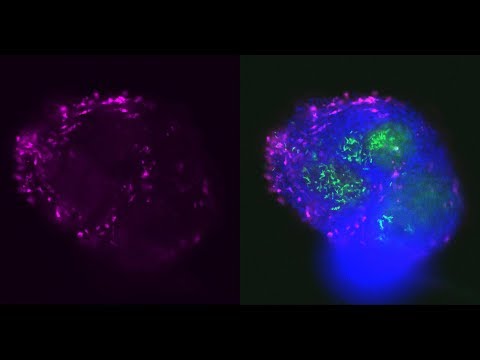 New Way to Study Tuberculosis