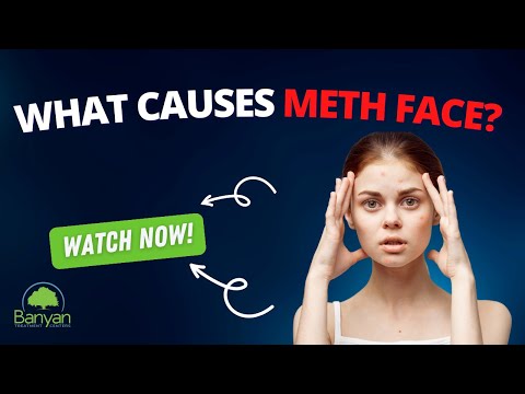 What is Meth Face?