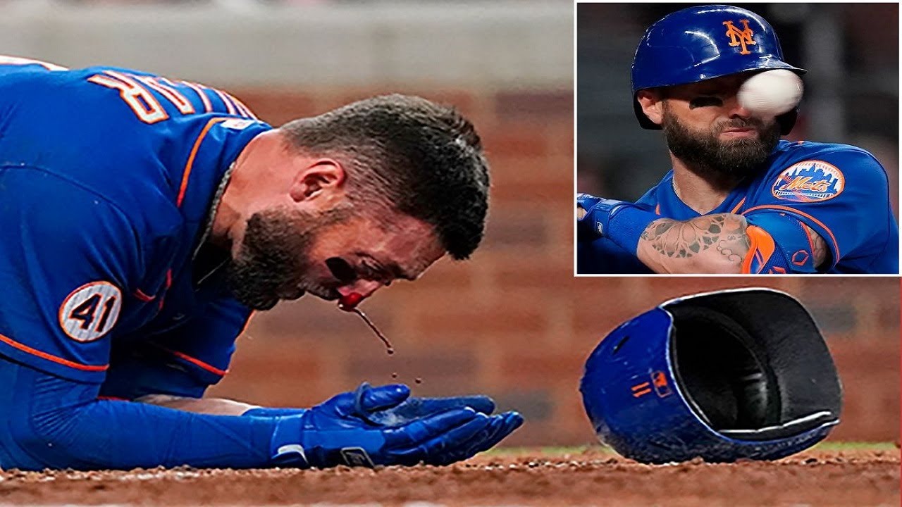 MLB Collection of serious injuries 2021