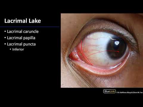 Lacrimal Caruncle