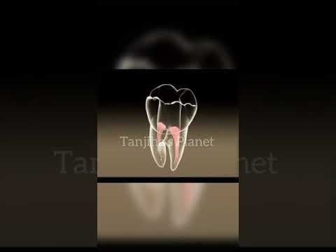 3D Root Canal Treatment 😳 #shorts #endodontics