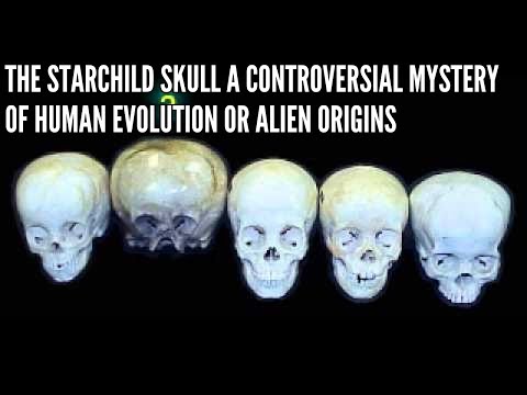The Starchild Skull A Controversial Mystery of Human Evolution or Alien Origins