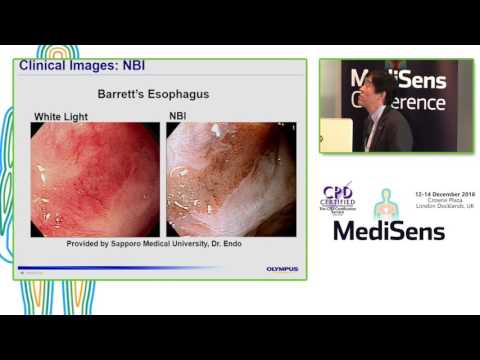 Medical endoscopic imaging and requirements for future image sensor design