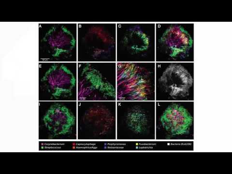 Ecological Diversity in the Microbiome - Kyle Bittinger PhD