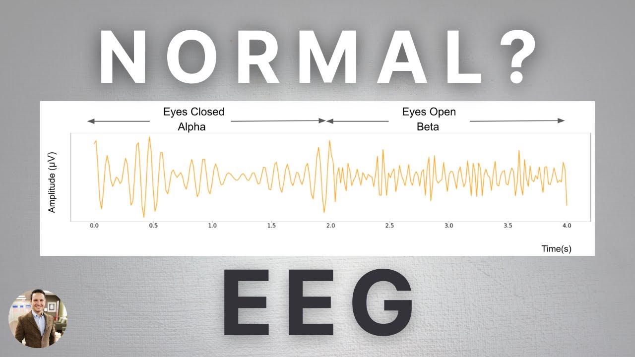 Alpha Brain Waves on EEG: What’s Normal and What’s Not?