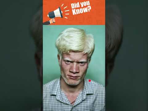 Albino Indians: Breaking the Stereotypes of Race and Color