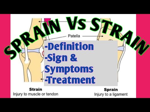Strain Vs Sprain