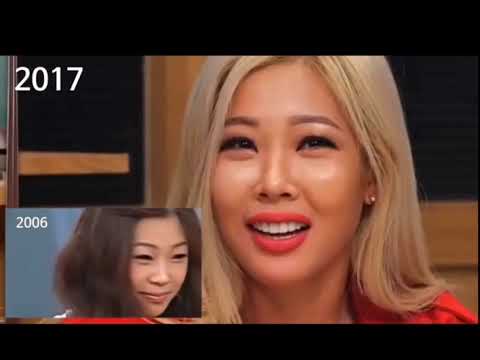 JESSIE BEFORE AND AFTER PLASTIC SURGERY/JESSIE EVOLUTION