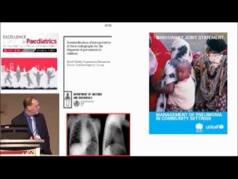 Management of community acquired pneumonia